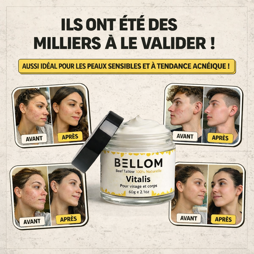 Vitalis - Beef Tallow – Bellom